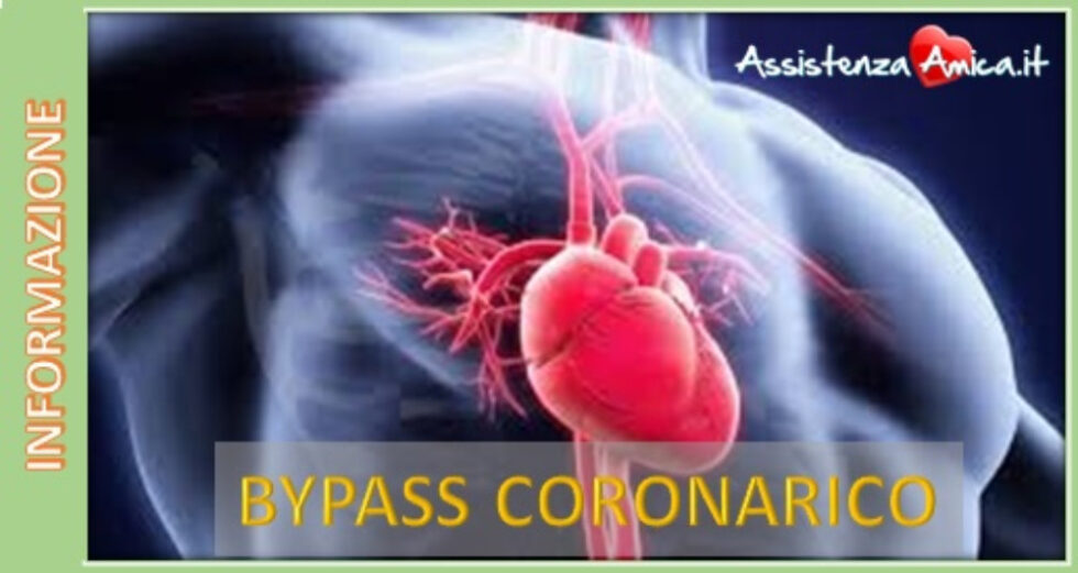 Bypass: tecnica chirurgica che ripristina il flusso sanguigno che ...